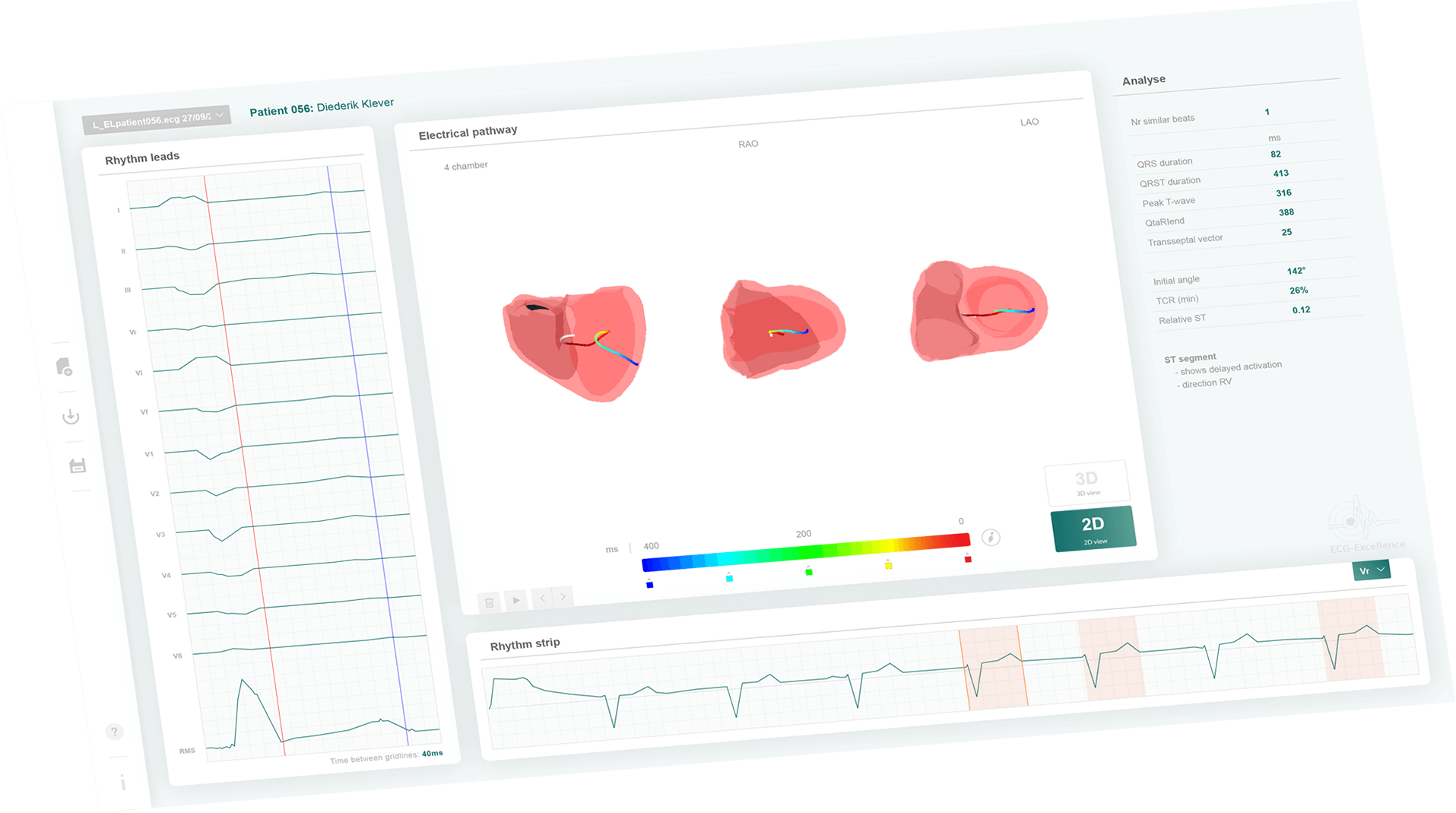 CineECG - About - ECG-Excellence