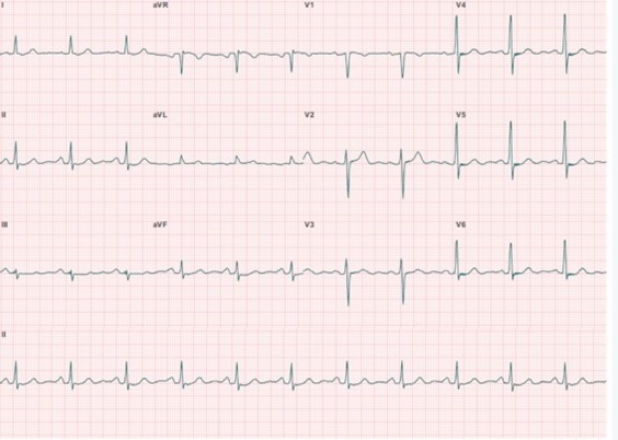 CineECG report vs2 - ECG-Excellence