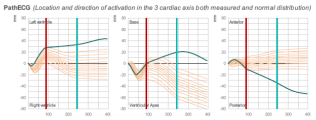 New dynamic view on the ECG - ECG-Excellence