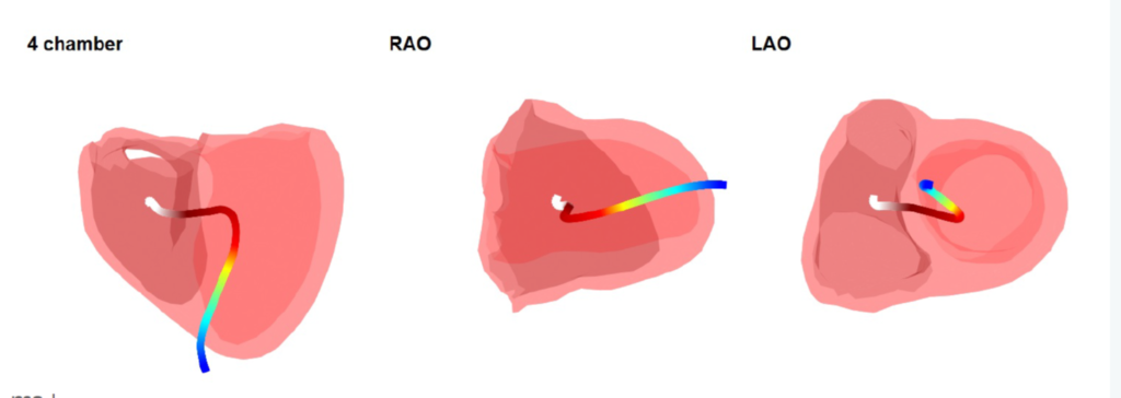 Mistakes in ECG interpretation - ECG-Excellence