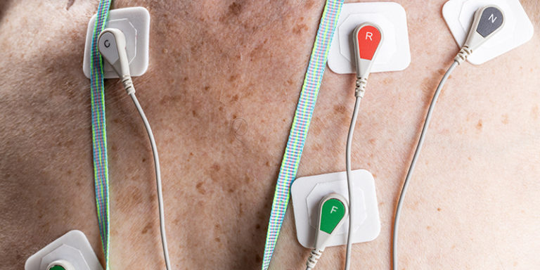 Screening for AF with ECG - ECG-Excellence