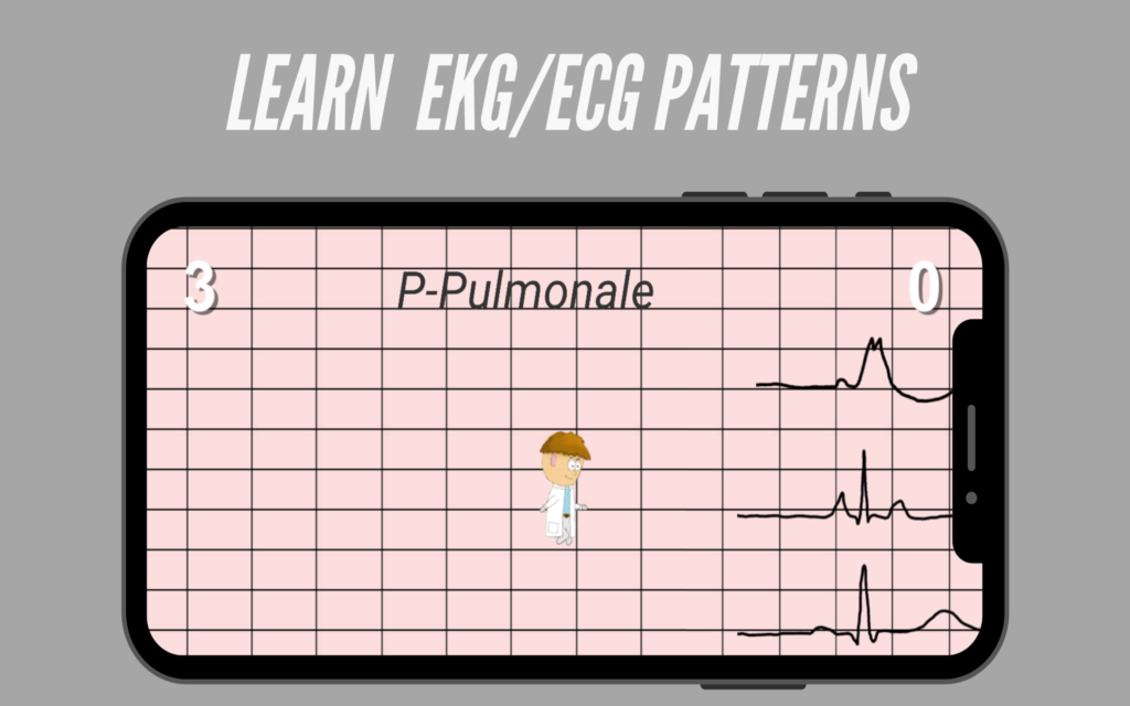 Learning ECG interpretation skills - ECG-Excellence