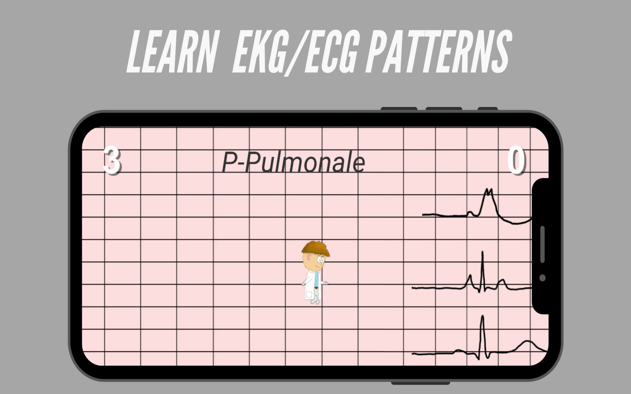 Learning ECG interpretation skills - ECG-Excellence