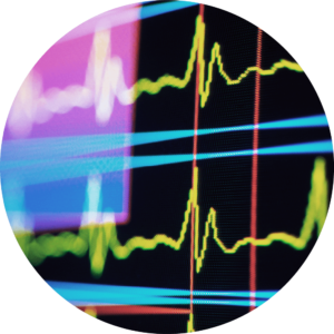 Understanding ECG the easy way - ECG-Excellence
